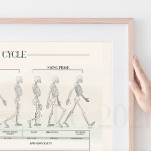 Gait Analysis Pattern Poster | Sandyspines | Art for Chiropractors ...