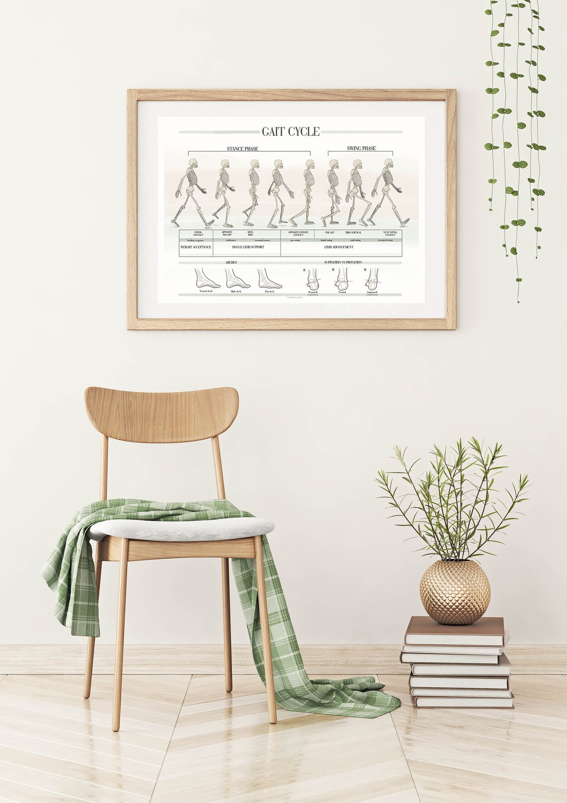 Gait Analysis Pattern Poster Sandyspines Art for | Etsy