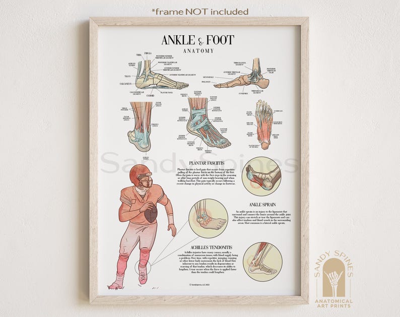 Ankle & Foot Anatomy and Injury Poster by Sandyspines | Chiropractic ...