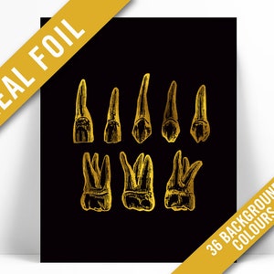 Human Teeth Gold Foil Print Dental Office Wall Art Anatomy | Etsy