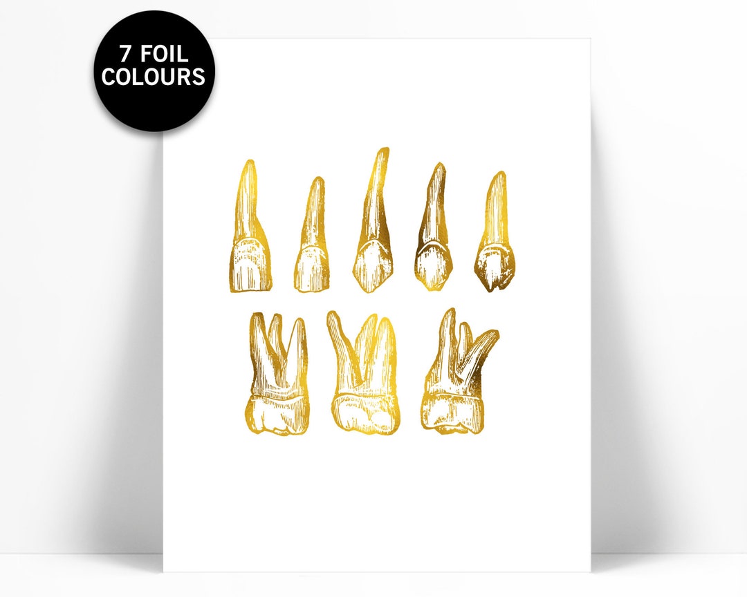 Human Teeth Gold Foil Print - Dental Office Wall Art - Anatomy Wall Art ...