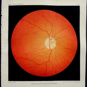 1854 Set of 8 Color Lithographs: Eye Anatomy Under an Opthalmoscope ...