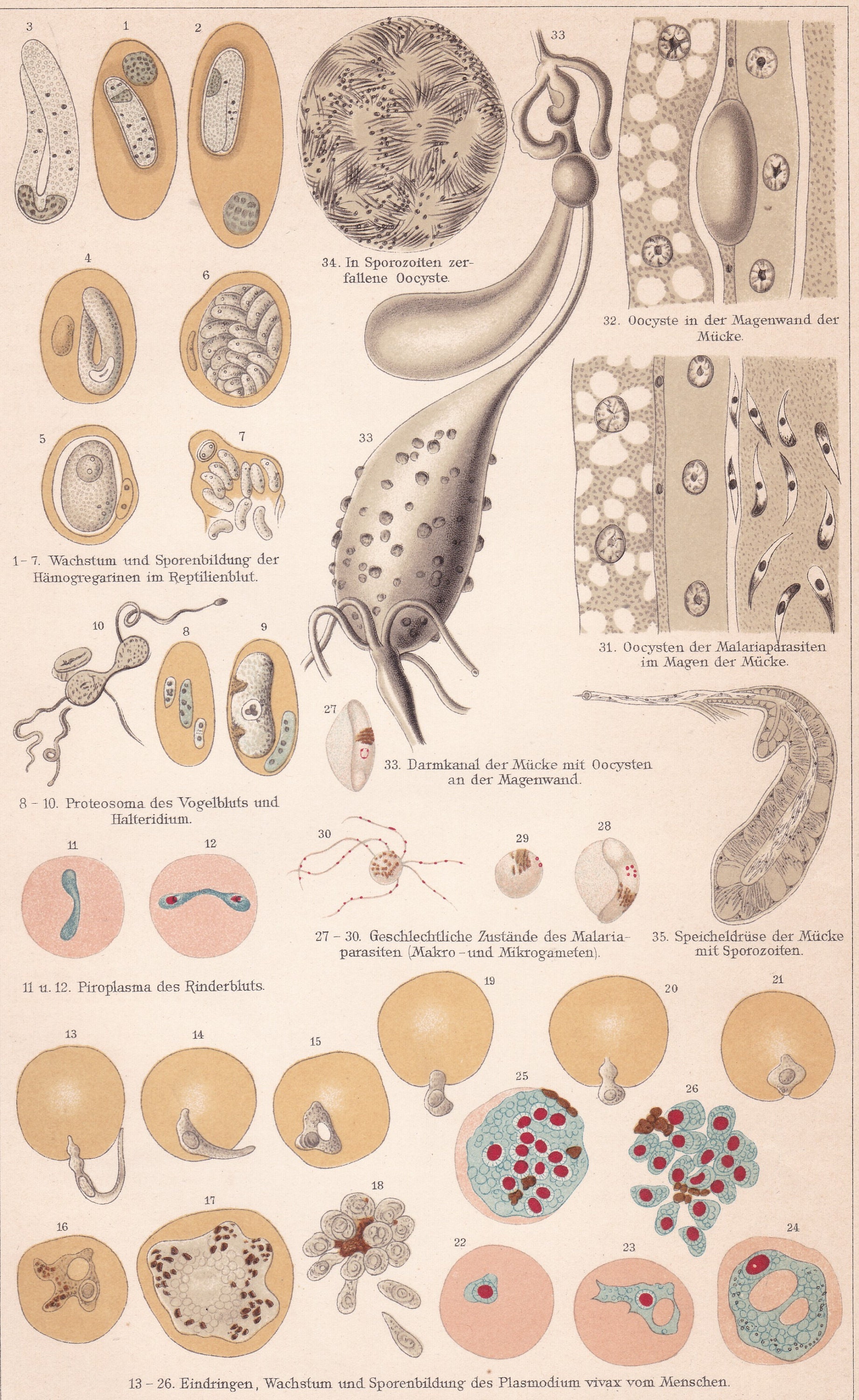 1896 PARASITES in HUMAN BODY Antique Lithograph Print, Anatomy, Human ...