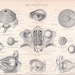 HUMAN ANATOMY EYE Ophthamology Antique Chromolithographic Prints - Etsy