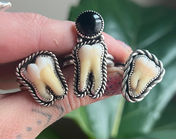 Your Own Custom Tooth Ring! - Etsy