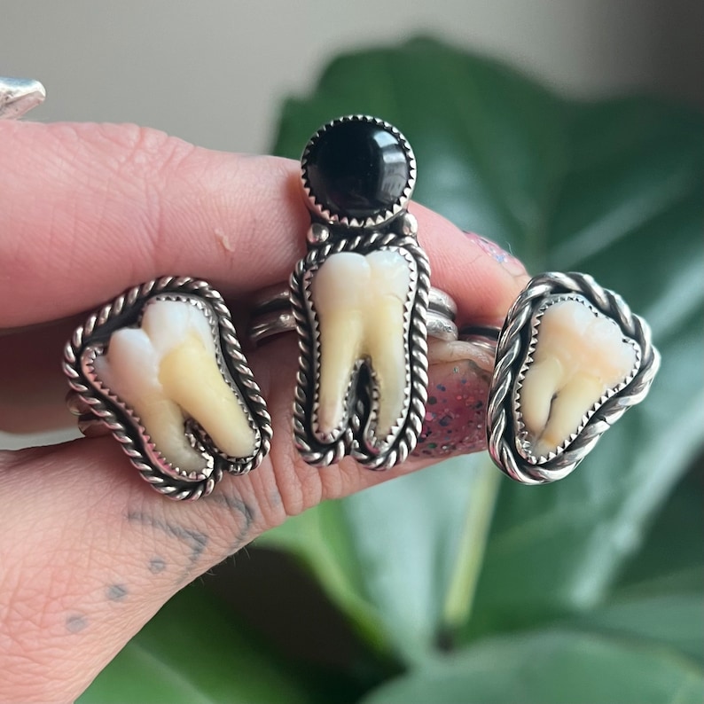 Your Own Custom Tooth Ring - Etsy