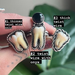 Your Own Custom Tooth Ring! - Etsy