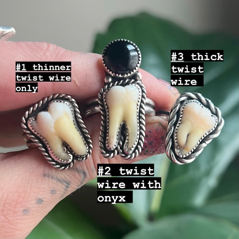 Your Own Custom Tooth Ring - Etsy