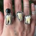 Your Own Custom Tooth Ring! - Etsy