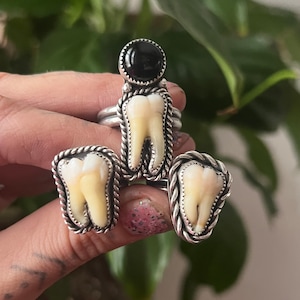 Your Own Custom Tooth Ring! - Etsy