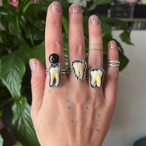Your Own Custom Tooth Ring! - Etsy