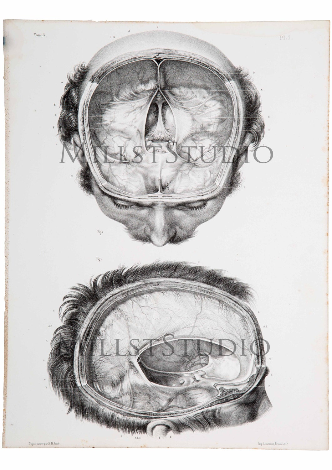 Anatomical Sheet. Dura-mére Encephalique. Encephalic Dura Mater ...