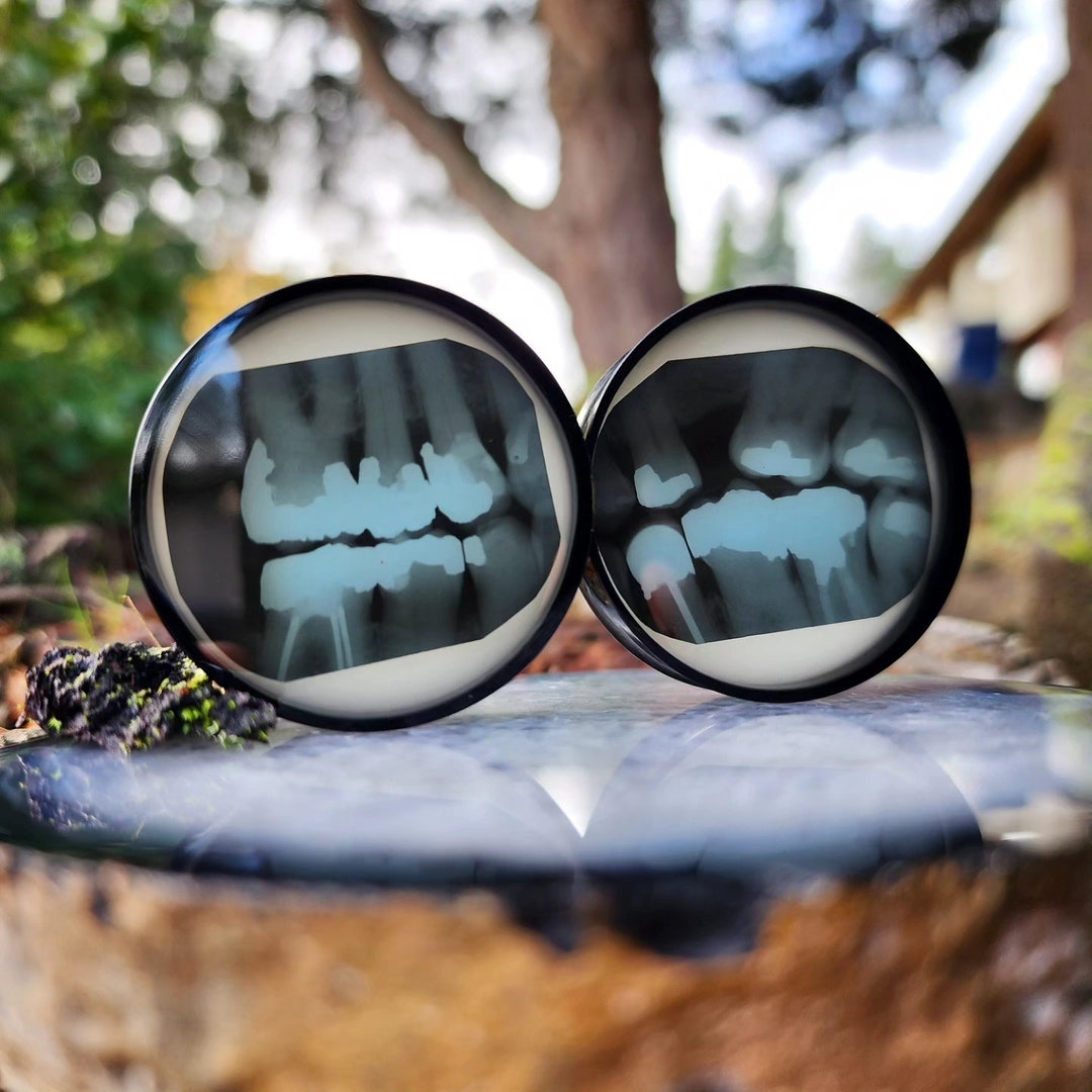 X-ray Plugs, Dental X-ray, X-ray, Dental, Resin Plugs, Set of Plugs ...