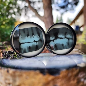 X-ray Plugs, Dental X-ray, X-ray, Dental, Resin Plugs, Set of Plugs ...