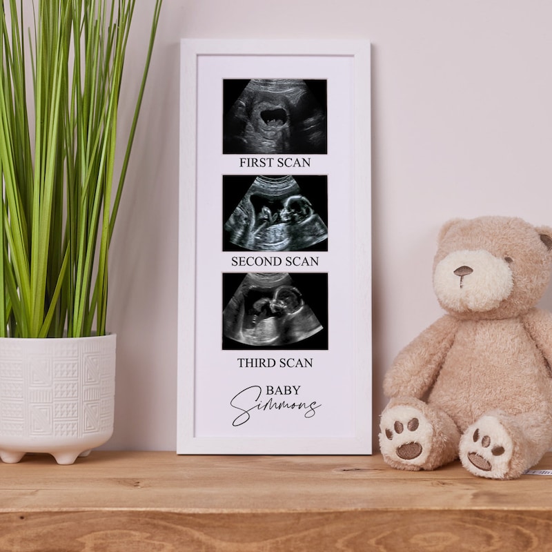 Frame With Scan Pic - Etsy UK