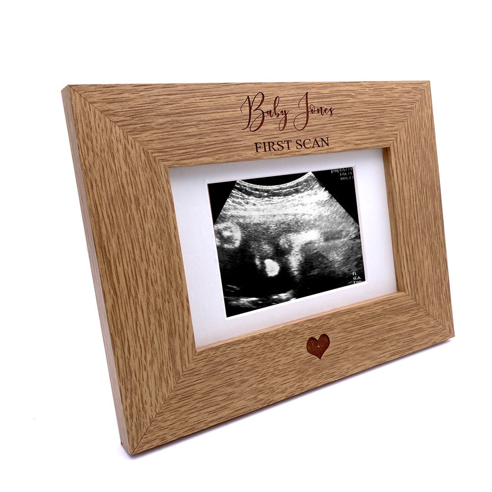 Personalised Baby First Scan Photo Frame | Etsy