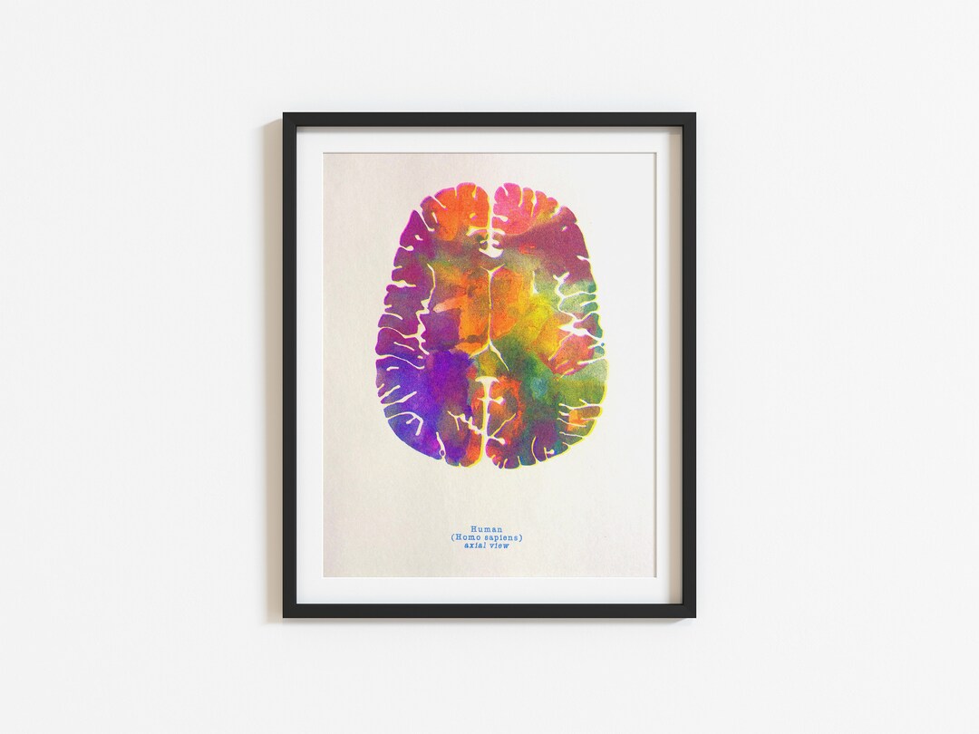 Axial Human Brain - Original 8.5" X 11" Risograph Print - Neuroscience ...