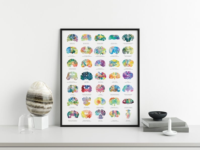Brain Anatomy Poster - 16" X 20" Oversized Wall Art - Great Medical ...
