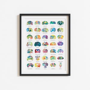 Brain Anatomy Poster - 16" X 20" Oversized Wall Art - Great Medical ...