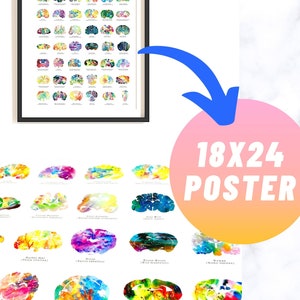 Brain Anatomy Poster - 18" X 24" Veterinary Poster - Veterinarian Tech ...