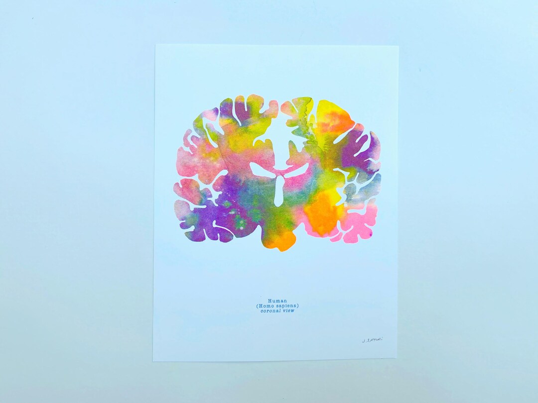 Risograph Print | Colorful Brain Art Print | Neuroscience Wall Art ...