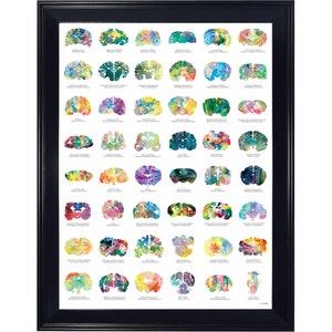 Brain Anatomy Poster - 18" X 24" - Animal Brain Art Poster - Great ...