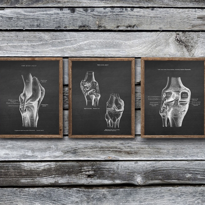 Anatomy Knee Artwork - Etsy