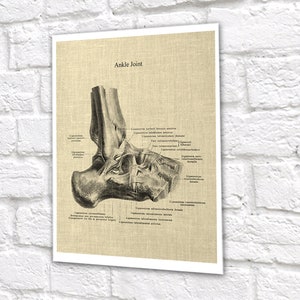 Orthopedic Posters Anatomy of Human Joints Set of 6 Unframed Hip ...