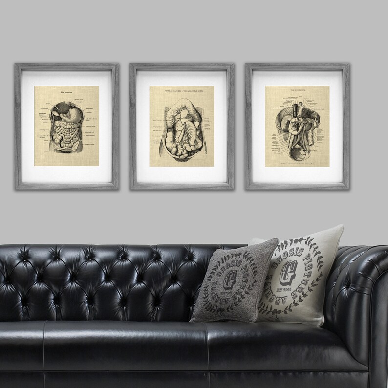 Gastrointestinal Anatomy Set of 3 Unframed Medical Decor Art Prints ...
