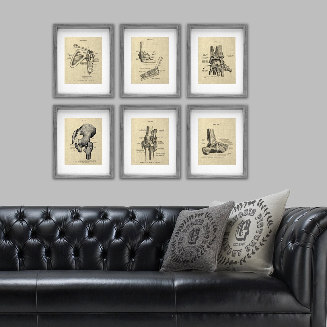 Orthopedic Posters Anatomy of Human Joints Set of 6 Unframed - Etsy