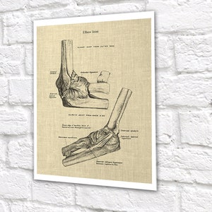 Orthopedic Posters Anatomy of Human Joints Set of 6 Unframed Hip ...