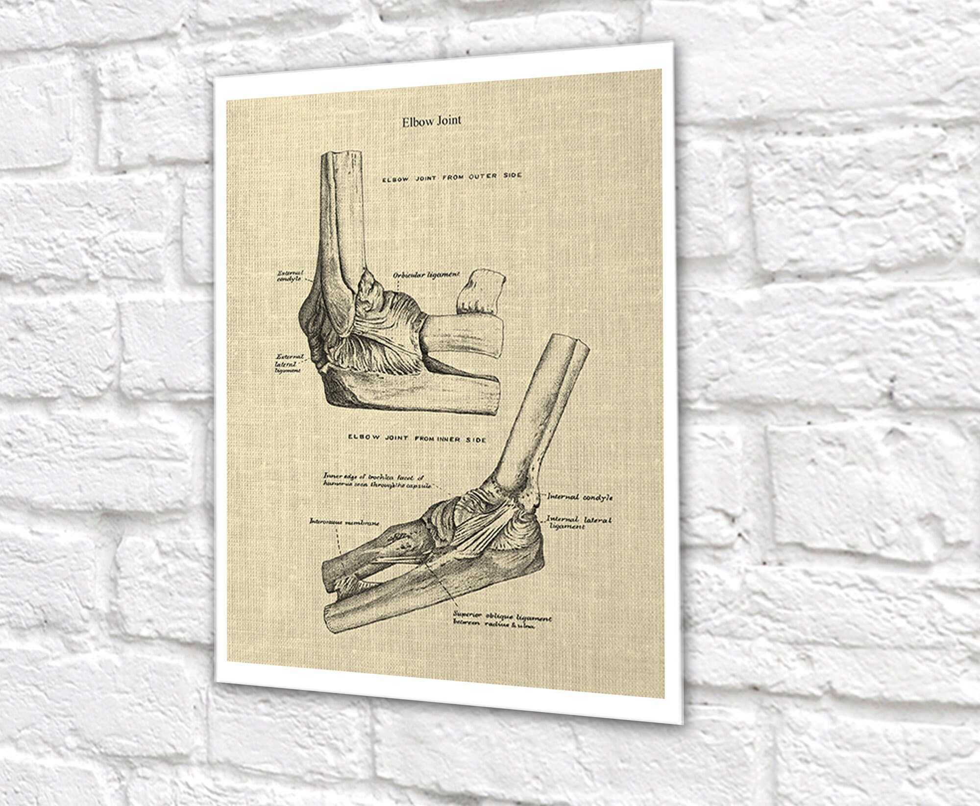 Orthopedic Posters Anatomy of Human Joints Set of 6 Unframed - Etsy