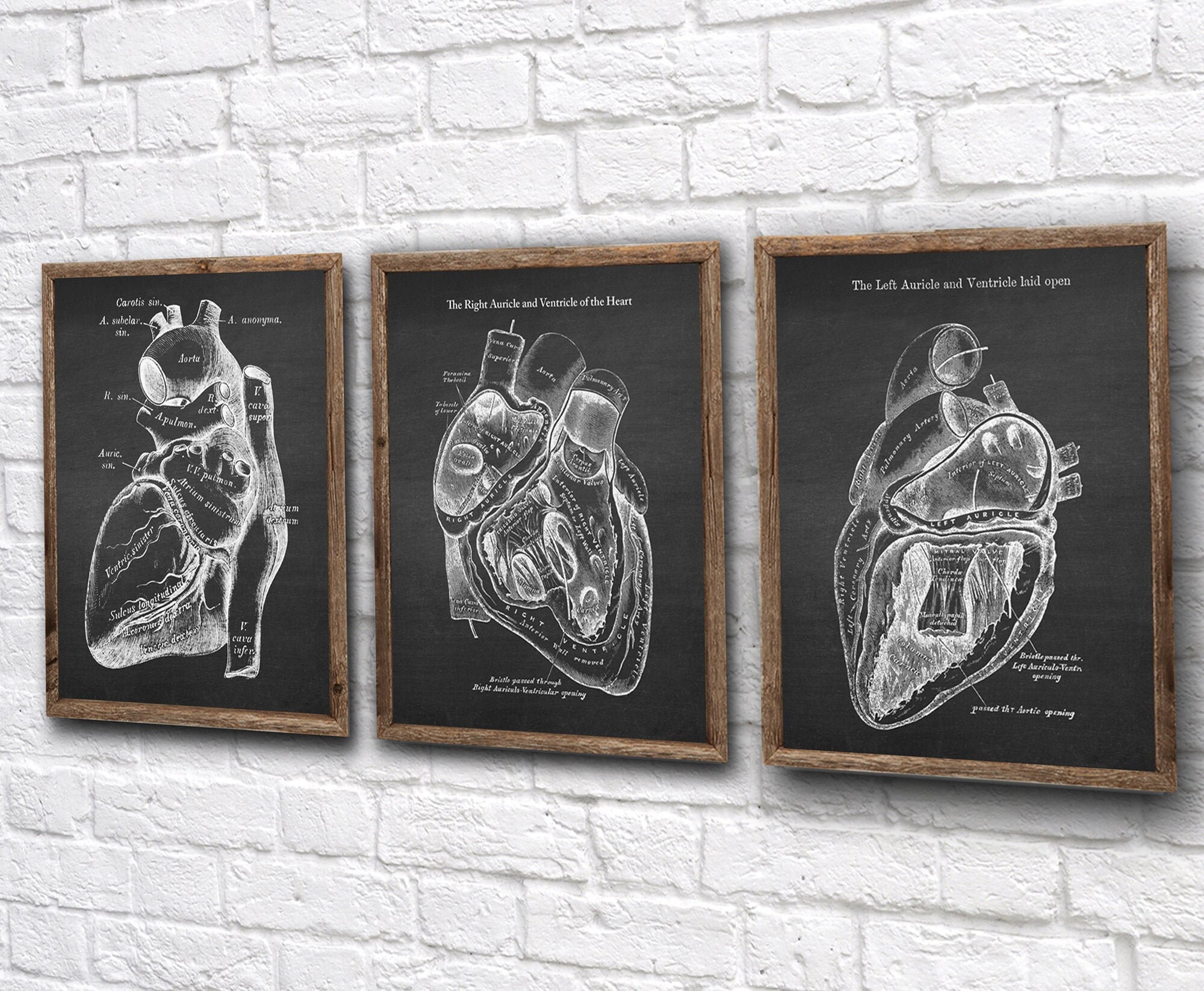 Anatomy Heart Art Prints Set of 3 Unframed Wall Art - Etsy