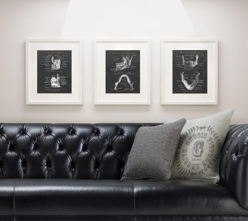 Dental Office Decor Teeth Anatomy, Chalkboard Style, Set of 9 Unframed ...