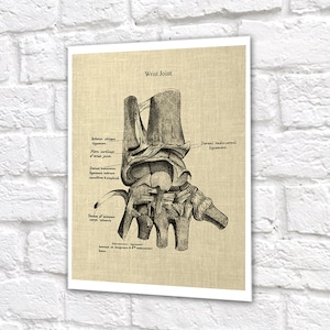 Orthopedic Posters Anatomy of Human Joints Set of 6 Unframed Hip ...
