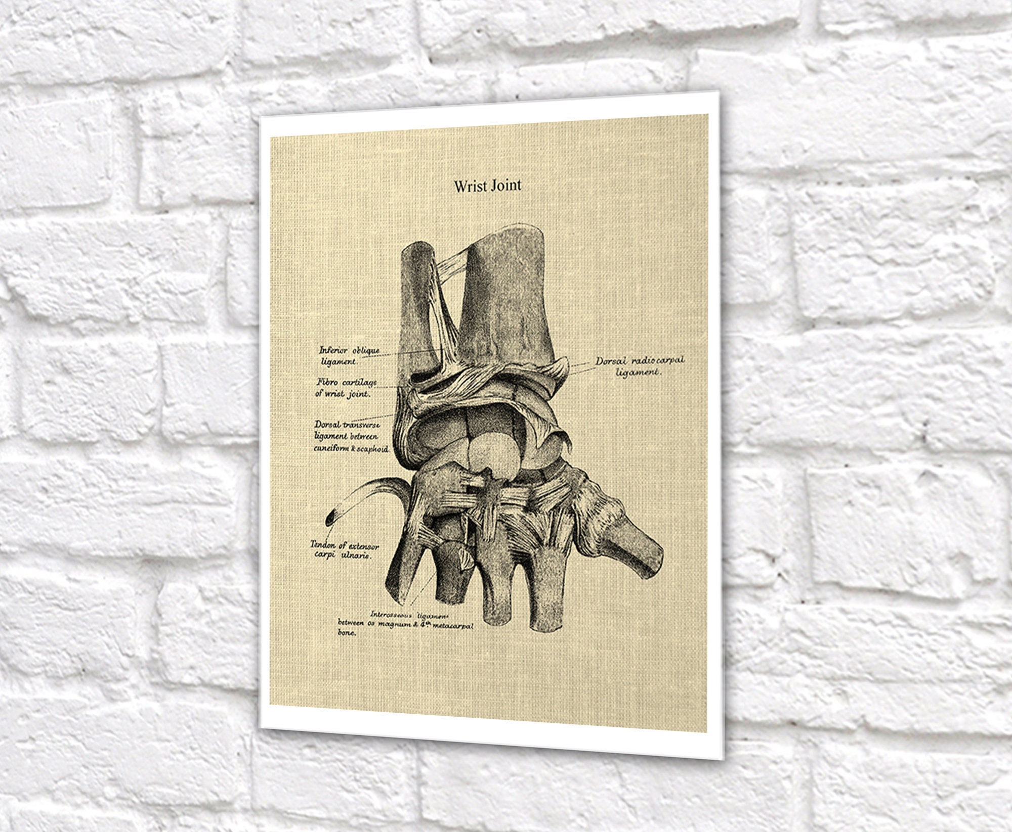 Orthopedic Posters Anatomy of Human Joints Set of 6 Unframed - Etsy