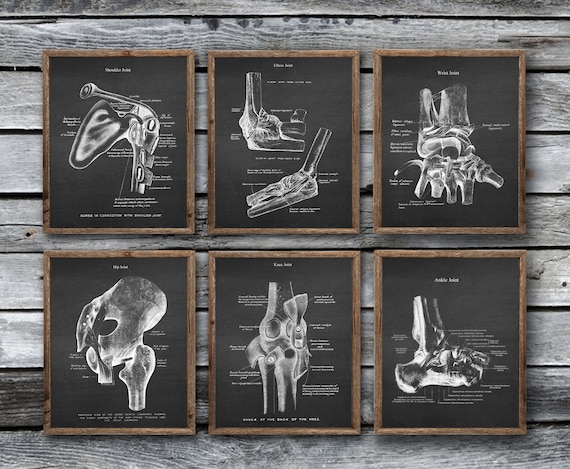 Orthopedic Posters Anatomy of Human Joints set of 6 Unframed | Etsy