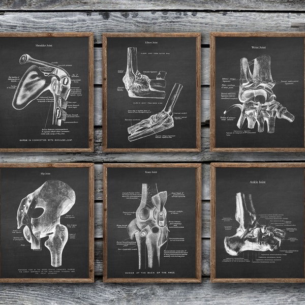 Orthopedic Poster - Etsy UK