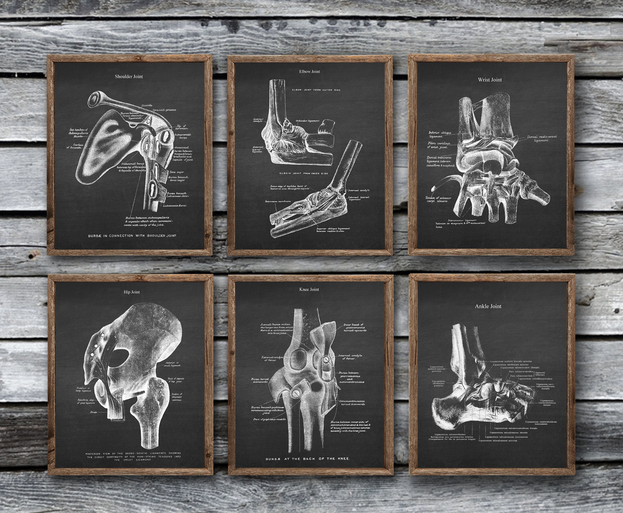 Orthopedic Posters Anatomy of Human Joints set of 6 Unframed | Etsy