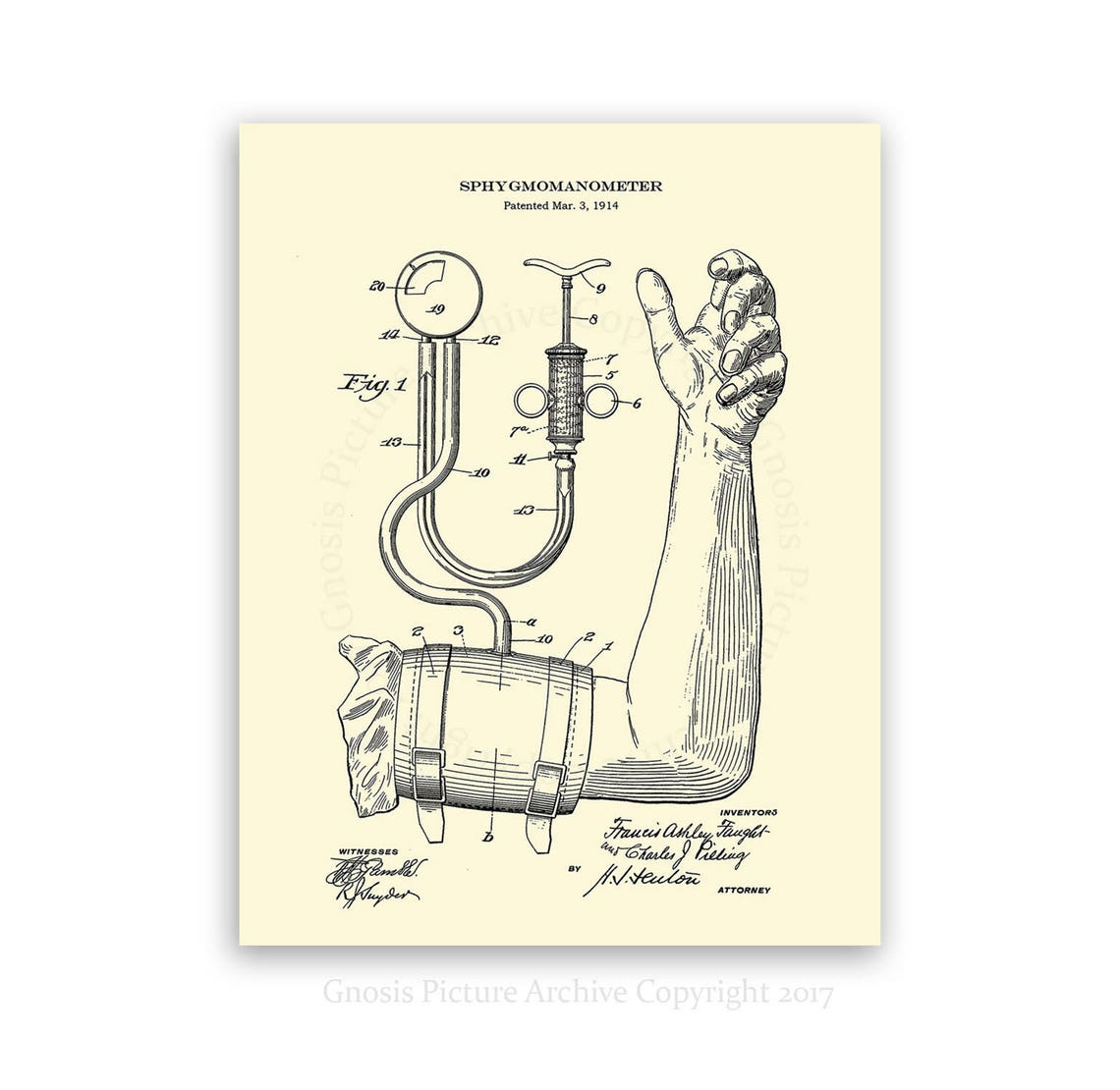 Blood Pressure Cuff Patent Art Print 3 Cream Colored Art | Etsy