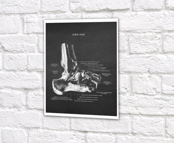 Orthopedic Posters Anatomy Of Human Joints Set Of Unframed