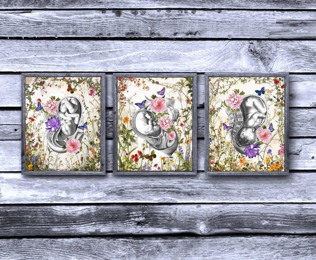 Pregnancy Womb Anatomy Art Set of 3 Unframed Decor Art Prints ...