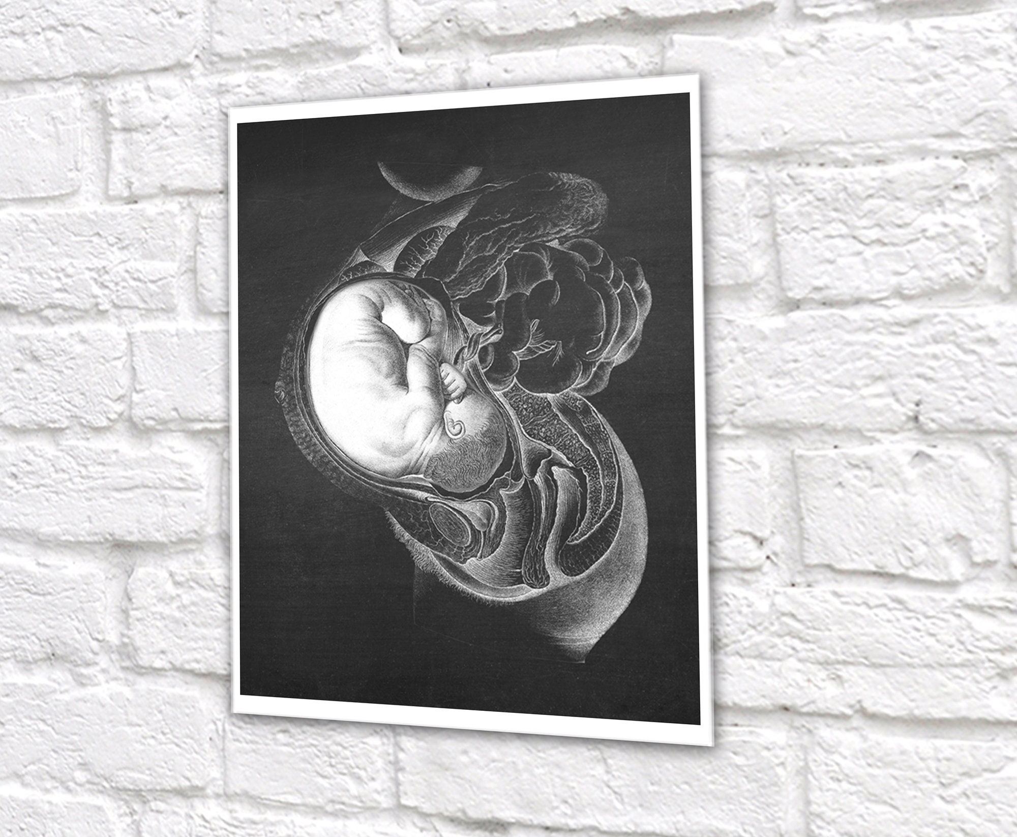 Pregnancy Womb Anatomy Art Set of 3 Unframed Decor Art Prints | Etsy