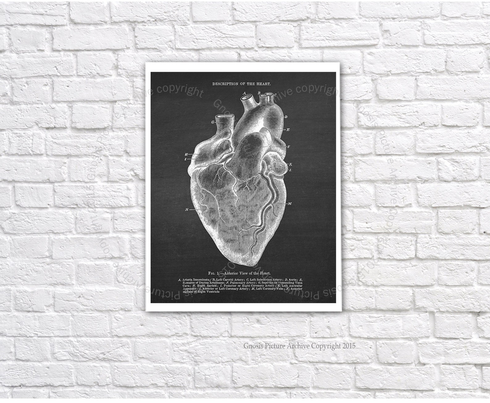 Anatomy Heart Art Prints Set of 3 Unframed Wall Art - Etsy