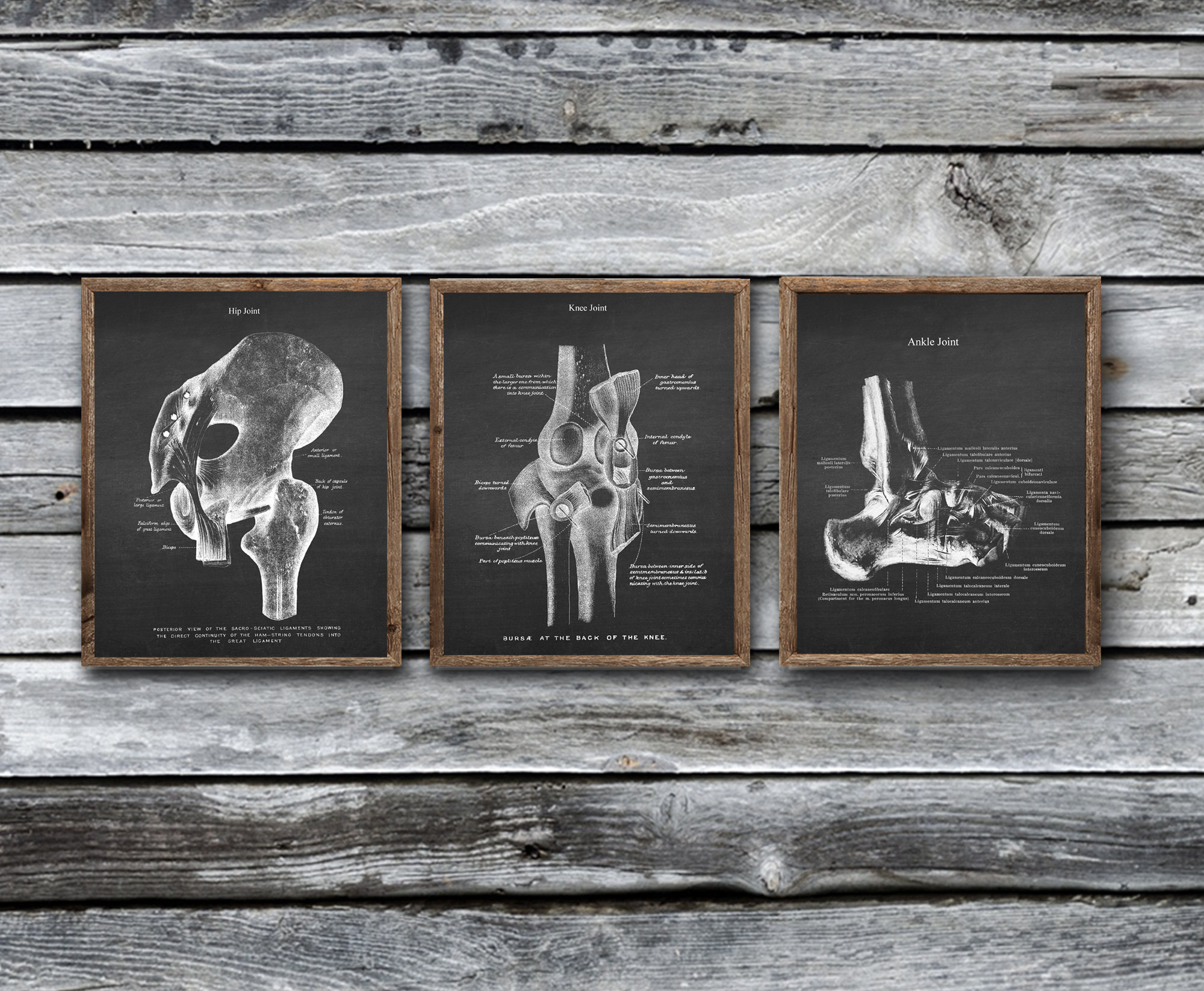 Orthopedic Doctor Decor Anatomy of Human Joints Set of 3 - Etsy