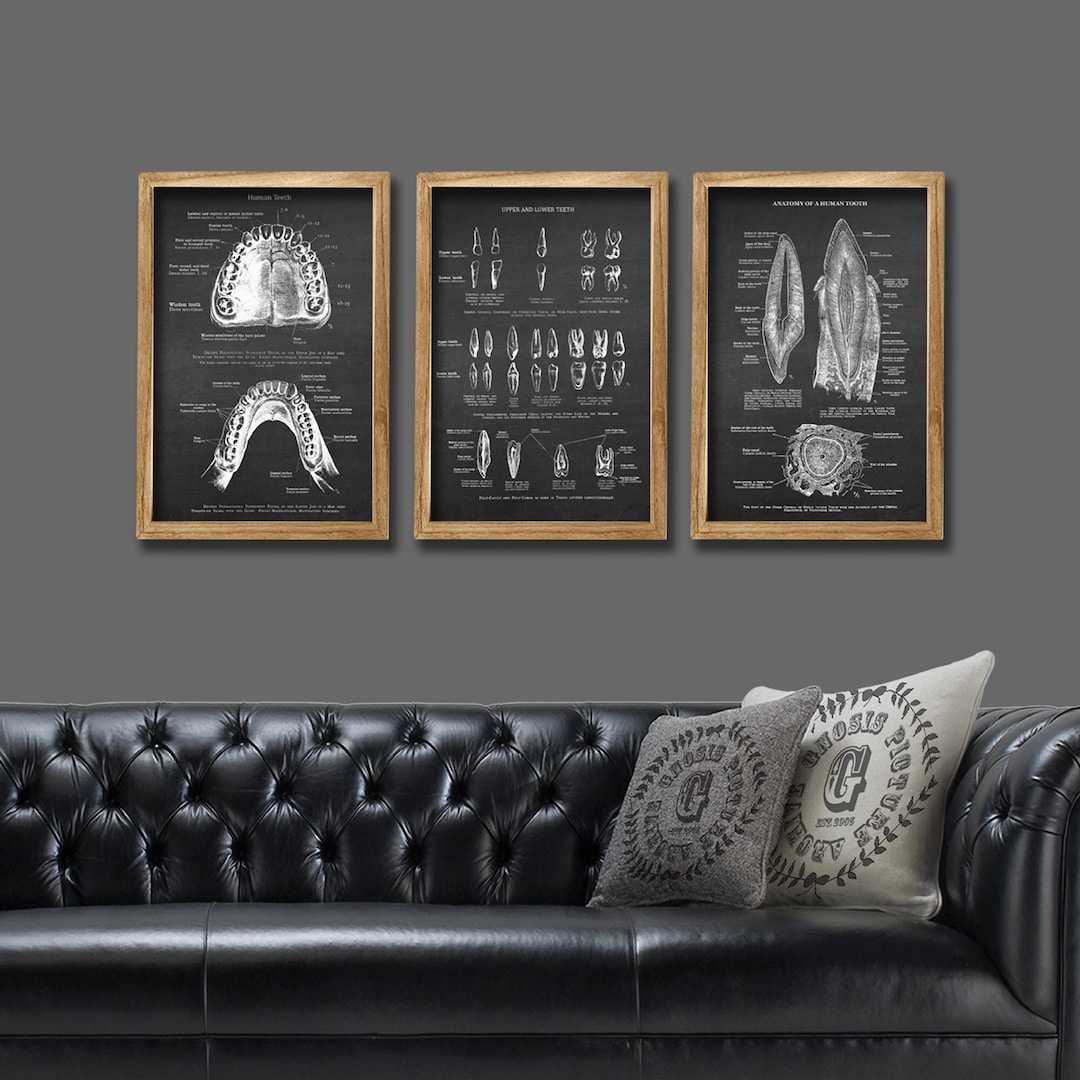 Anatomy of Human Teeth Charts Set of 3 Unframed Dental Office Wall Art ...