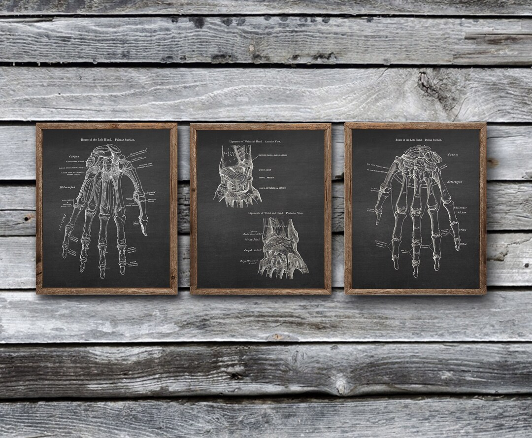 Hand Anatomy Art Prints, Chalkboard Bone Decor (set of 3) - Etsy