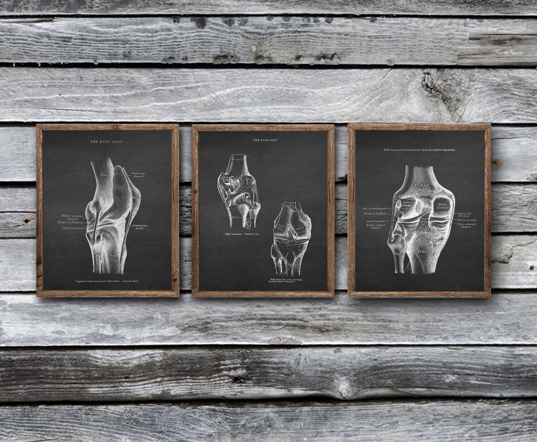 Knee Joint Anatomy Art Prints Set of 3 Unframed Orthopedic / Physical ...