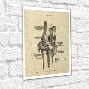 Orthopedic Posters Anatomy of Human Joints Set of 6 Unframed Hip ...