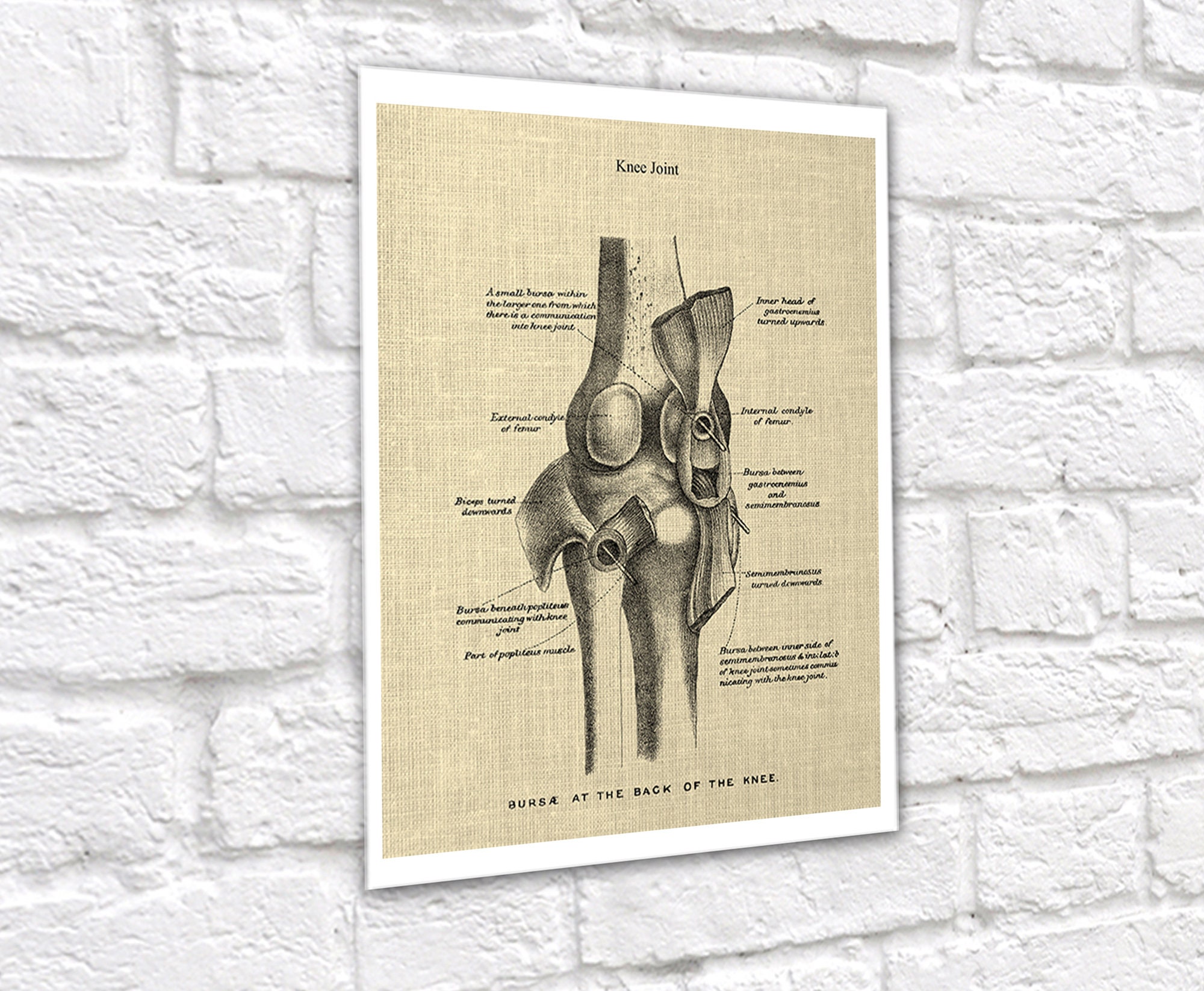 Orthopedic Posters Anatomy of Human Joints Set of 6 Unframed - Etsy